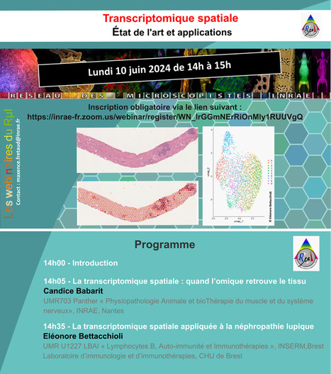 Webinaire "Transcriptomique spatiale : &ea...