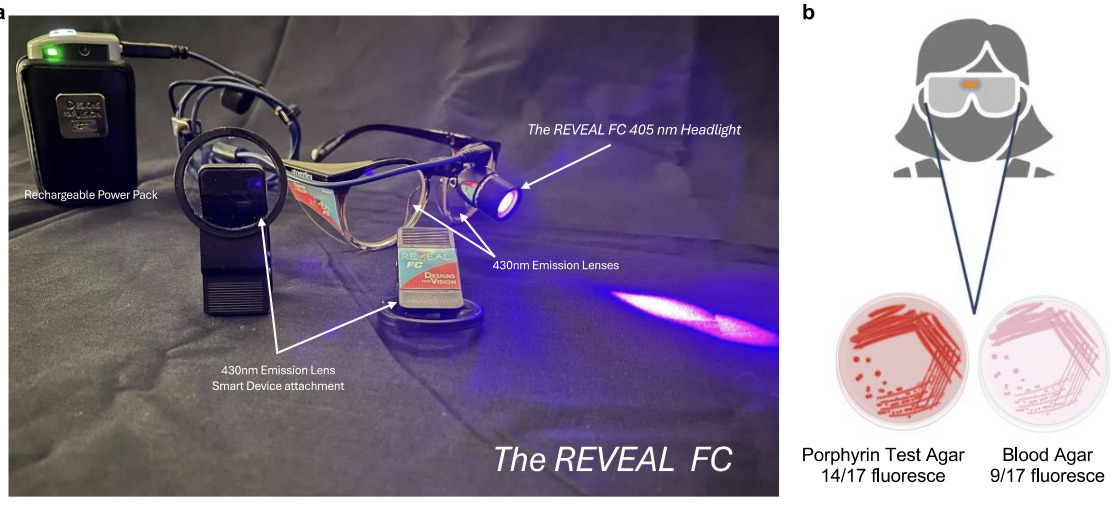 Imaging of porphyrin-specific fluorescence in p...
